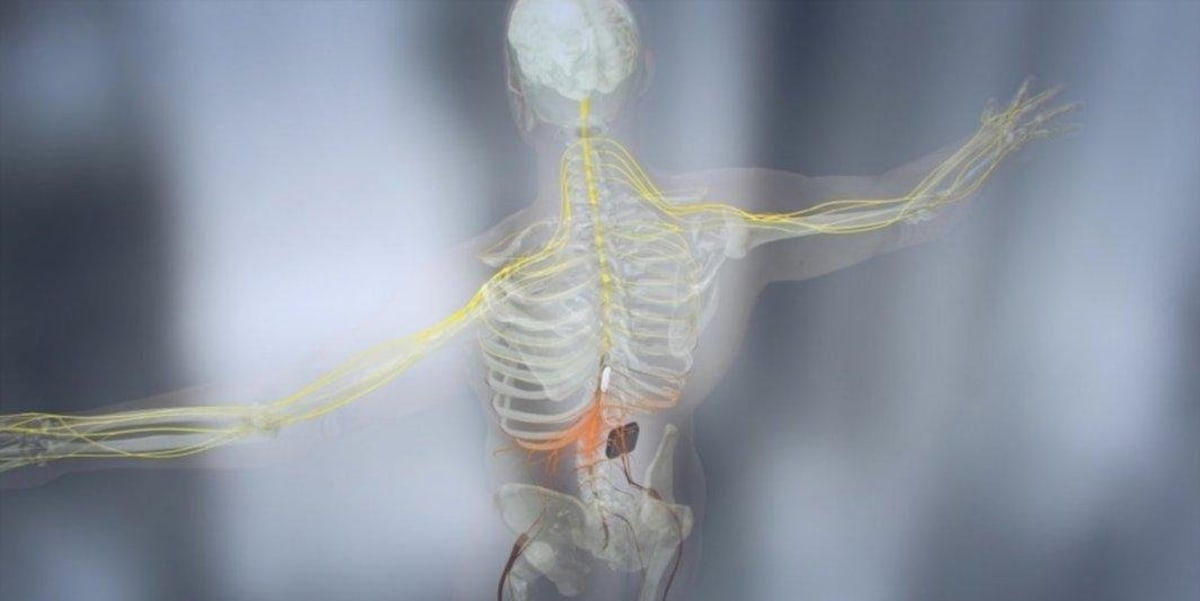 Zgodovina epiduralne stimulacije