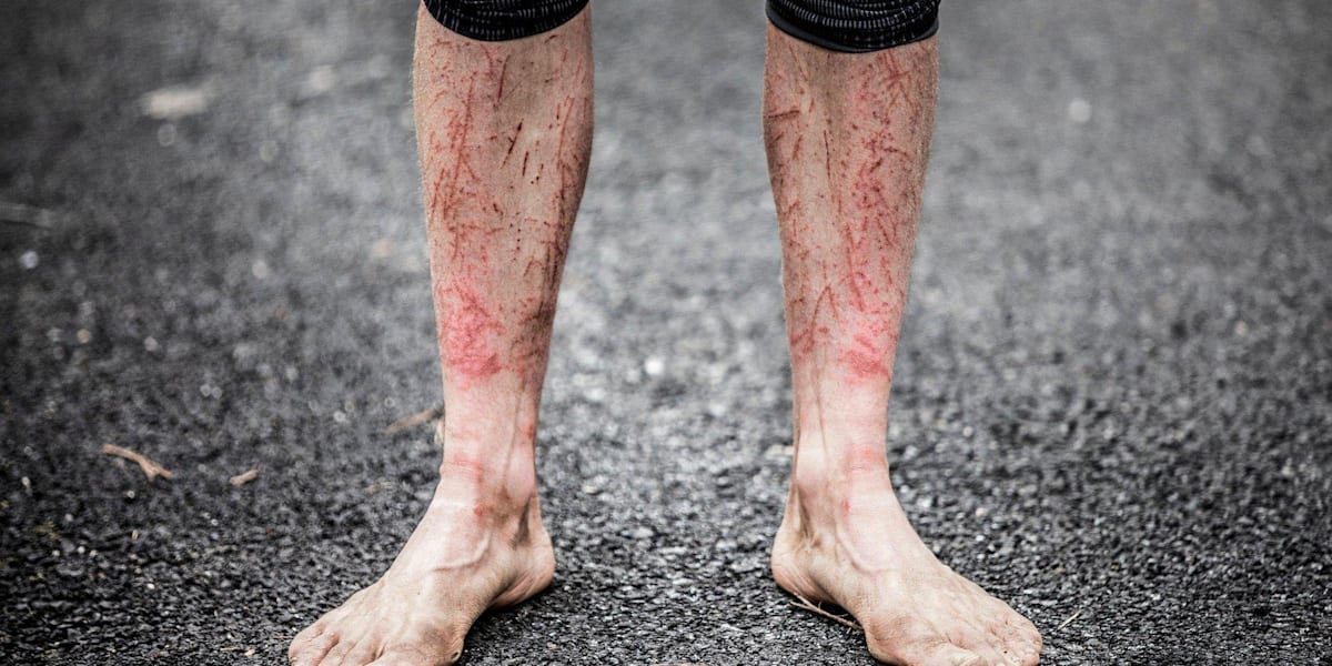 The Barkley Marathons guide: A brutal running adventure