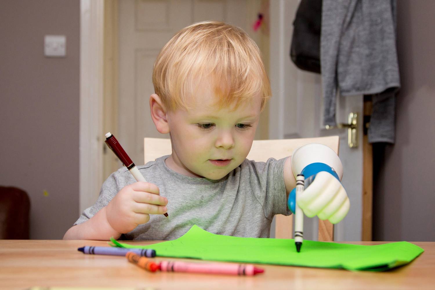 Ambionics: The spider-inspired prosthetic toddler arm