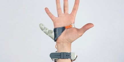 Third Thumb Project: Dani Clode & his 3D-printed thumb