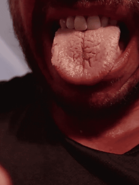 Ross Edgley's tongue falls out during epic swim attempt