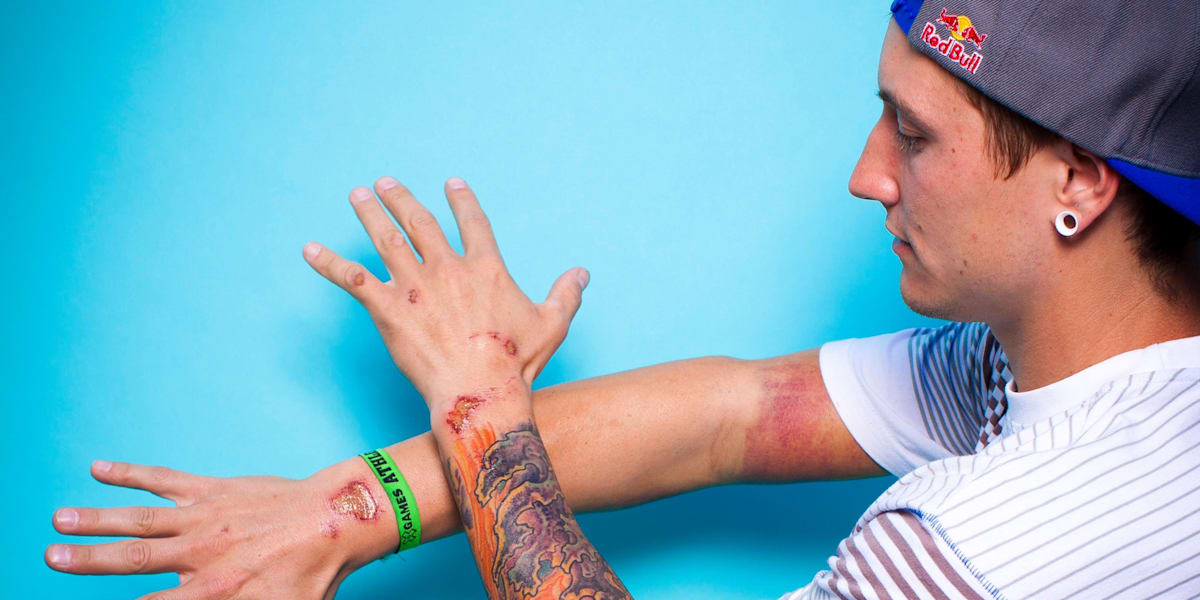 Exclusive X Games interview: Anthony Napolitan