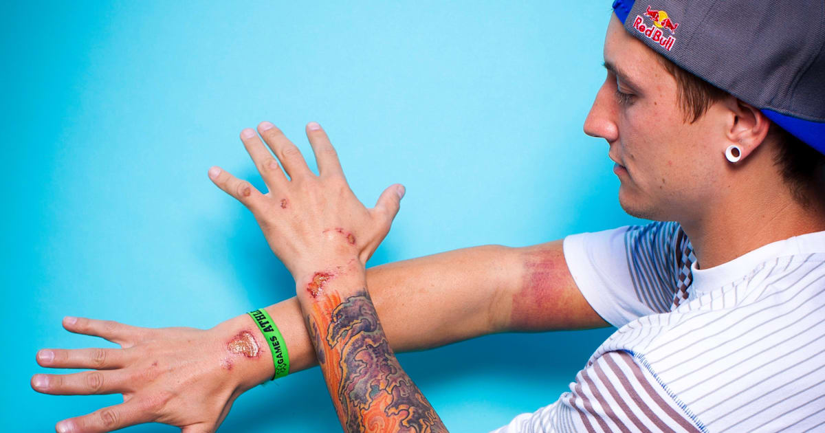 Exclusive X Games interview: Anthony Napolitan
