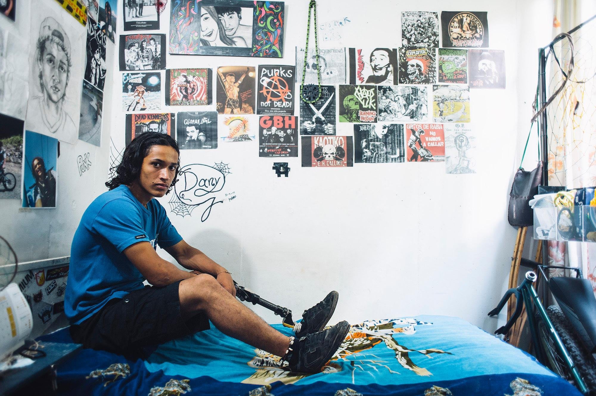 Julian Molina: Meet the one-legged BMX rider